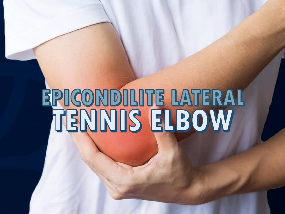 Tratamento da Epicondilite Lateral - Portal Doutor Meirelles®